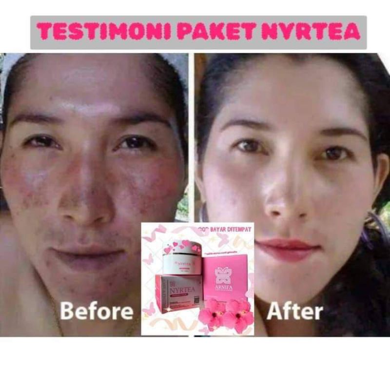 Nyrtea Price & Promotion-May 2024|BigGo Malaysia