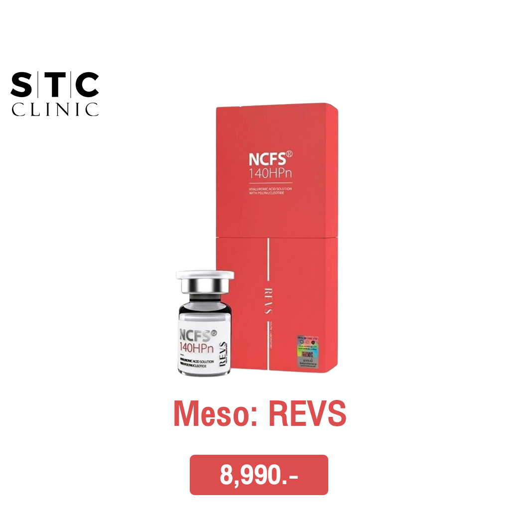 Revs ถูกที่สุด พร้อมโปรโมชั่น ก.พ. 2024|BigGoเช็คราคาง่ายๆ